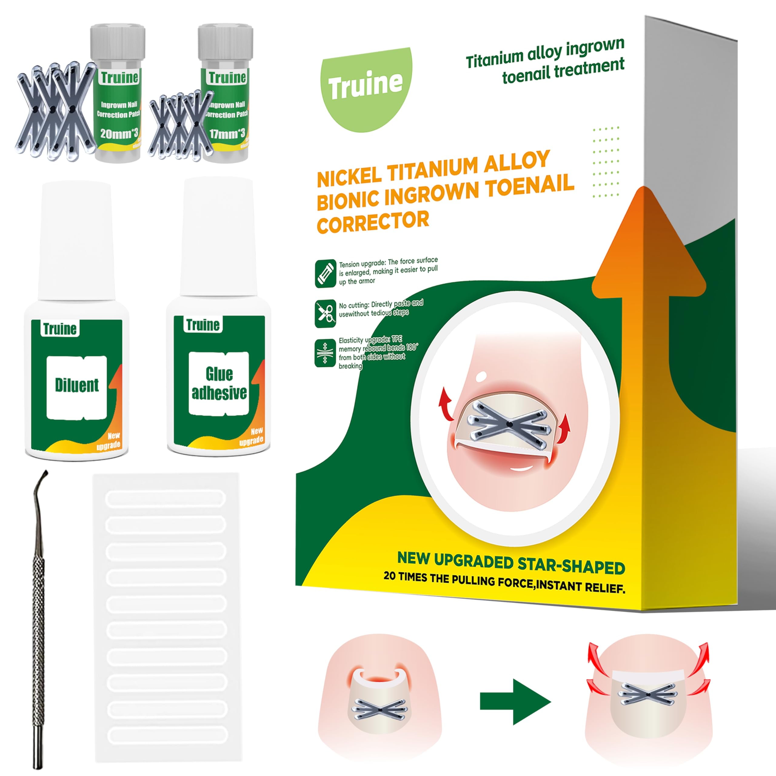 Truine Enhanced Titanium Ingrown OIF8 Toenail Corrector, ingrown ...