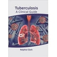 Tuberculosis: A Clinical Guide, (Hardcover) - Walmart.com