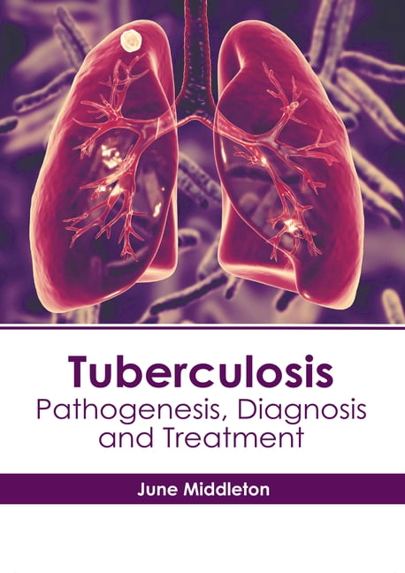 Tuberculosis: Pathogenesis, Diagnosis and Treatment, (Hardcover ...
