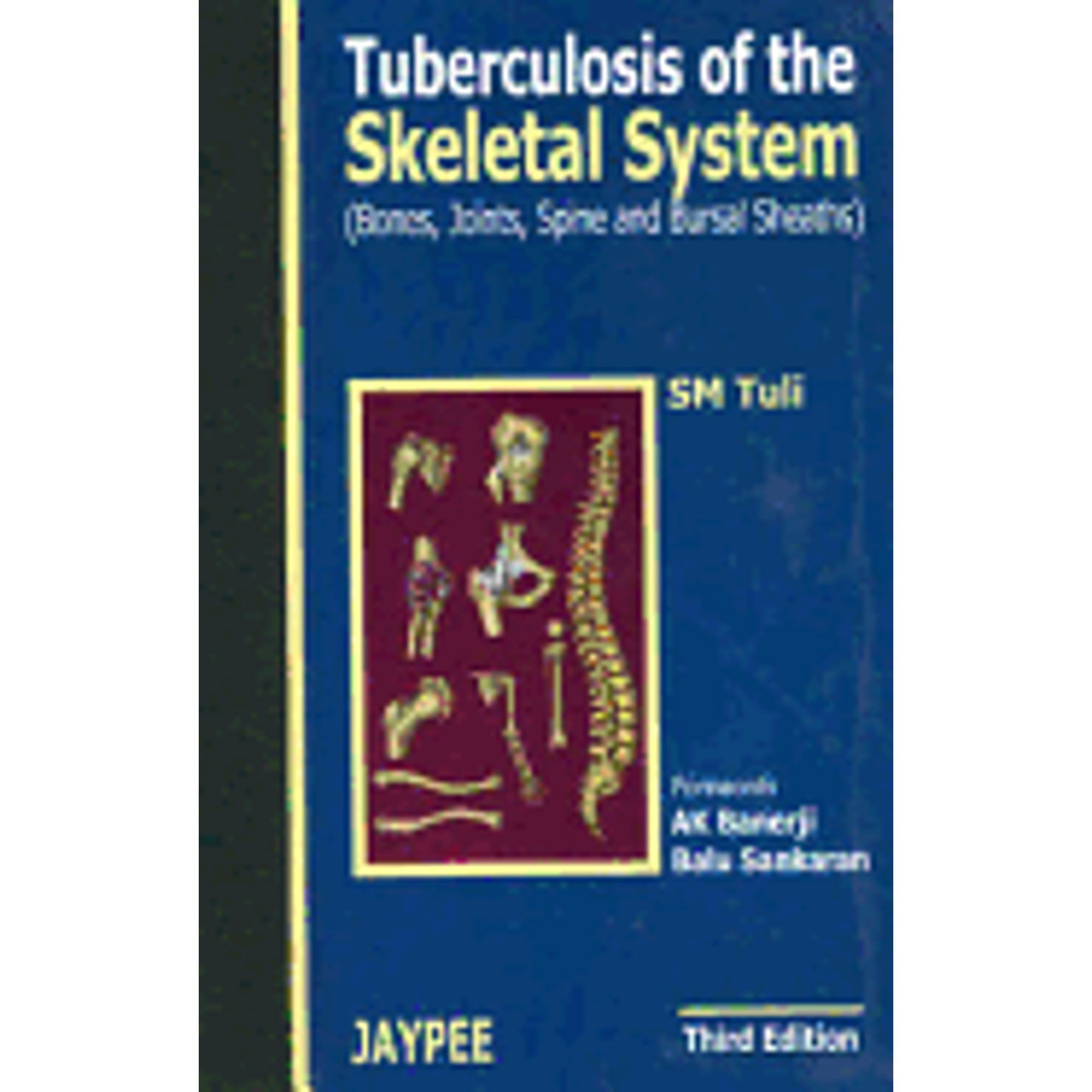Tuberculosis of the Skeletal System: Bones, Joints, Spine and Bursal ...
