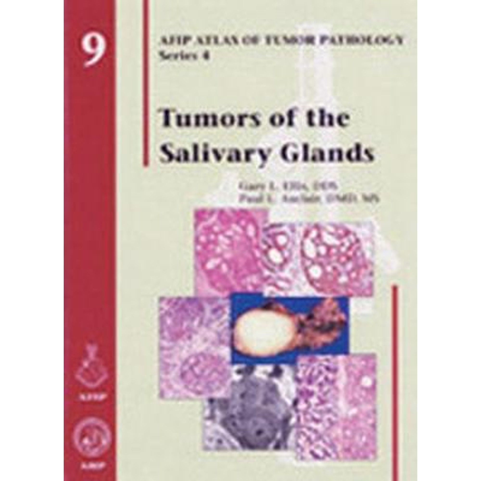 Pre-Owned Tumors of the Salivary Glands (AFIP Atlas of Tumor Pathology: Series 4), Used ...