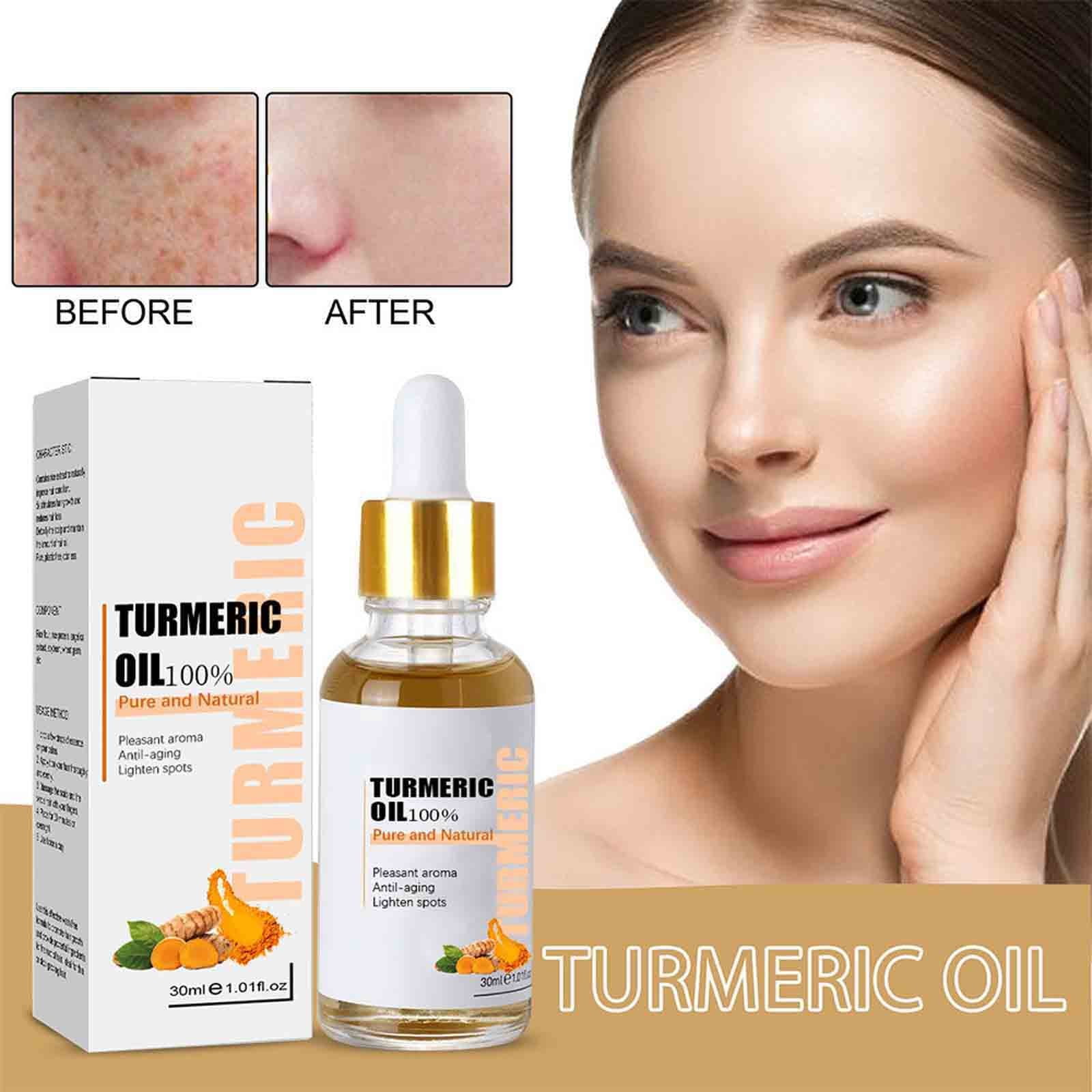Turmeric Dark Spot Corrector Serum Oil, Repair Face Serum, Natural Turmeric Bright Skin Care ...