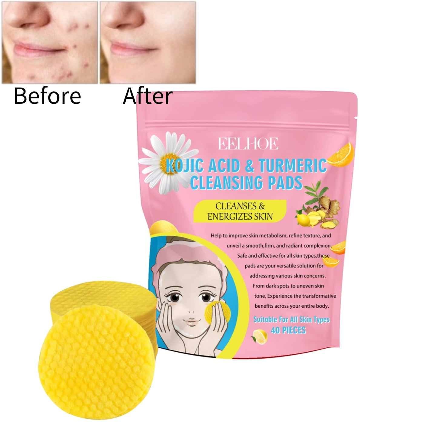 Turmeric Kojic Acid Cleansing Pads, Turmeric Cleansing Pads for Dark ...