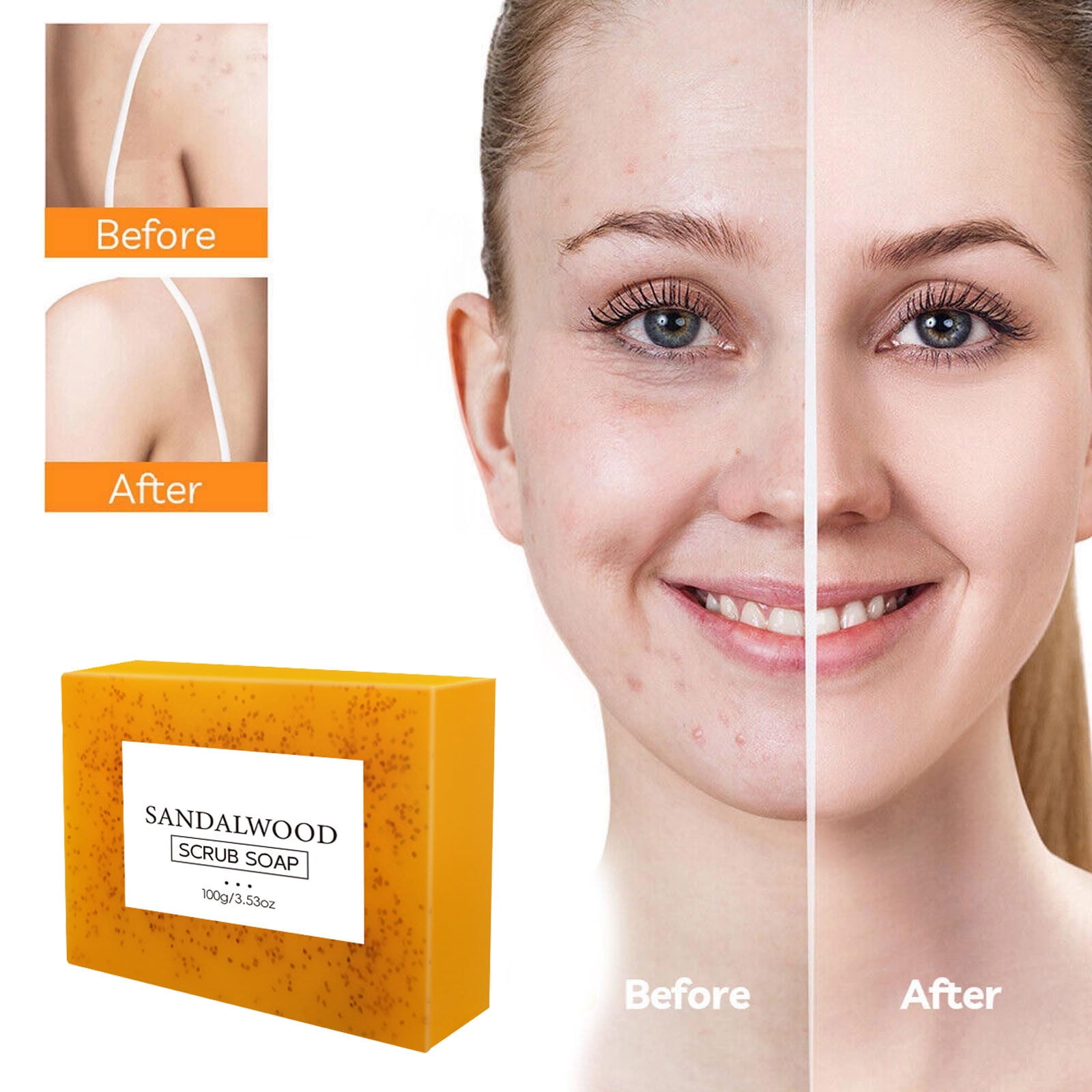 Turmeric Lemon Soap Tablets | Cleansing Facial & Body Bar | Kojic Acid ...