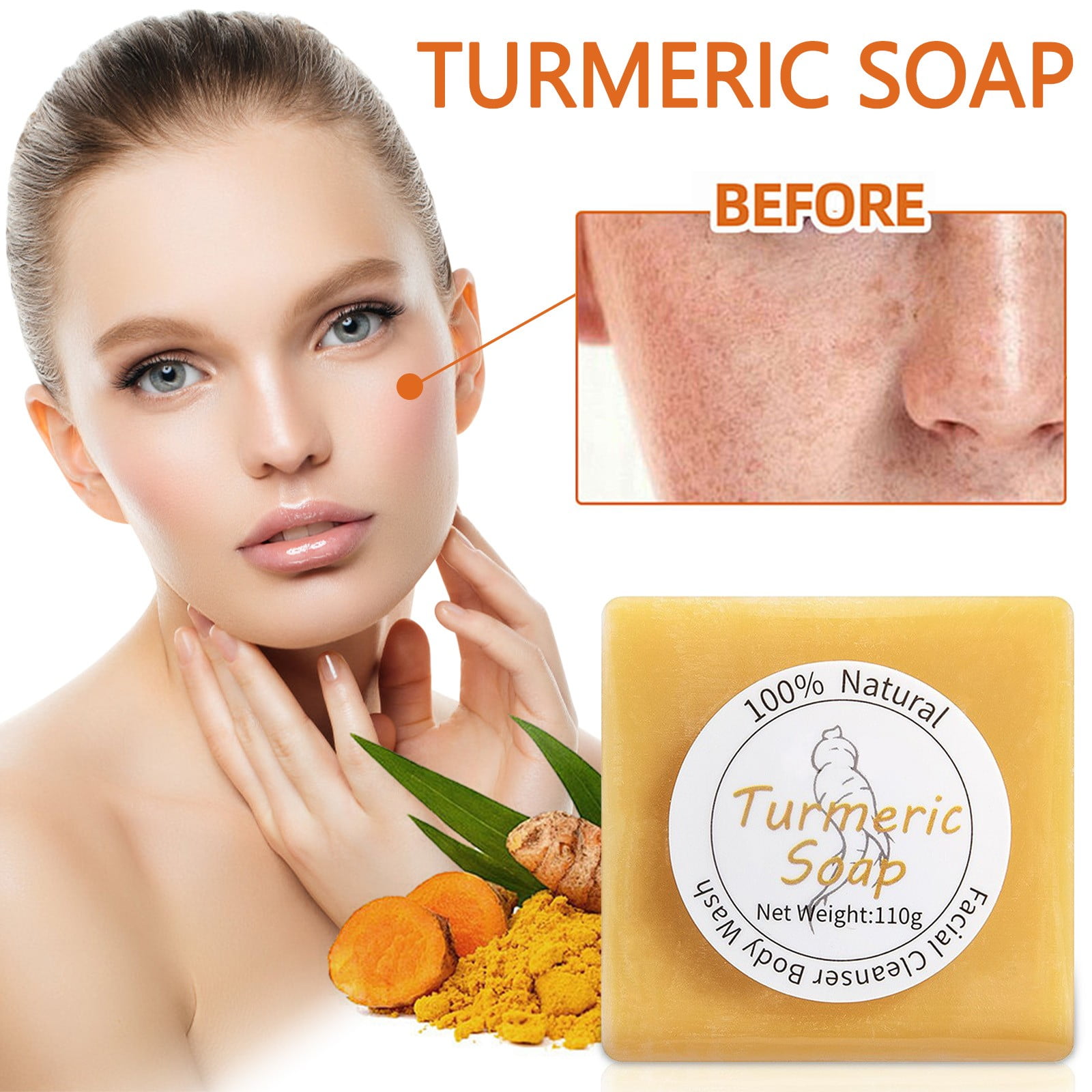 Turmeric Soap Bar For Acne And Dark Spots - Turmeric Face Cleansing ...