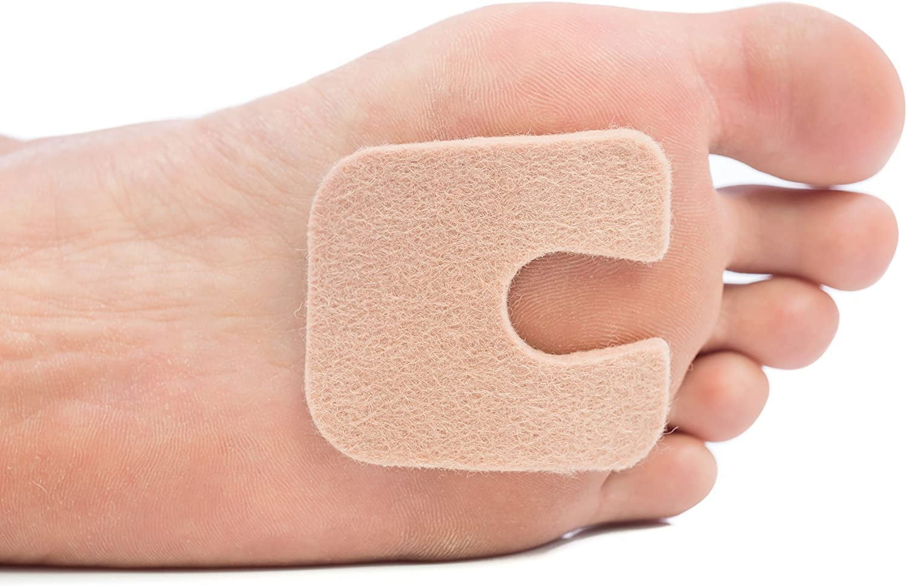 U-Shaped Felt Callus Pads | Protect Calluses from Rubbing on Shoes ...