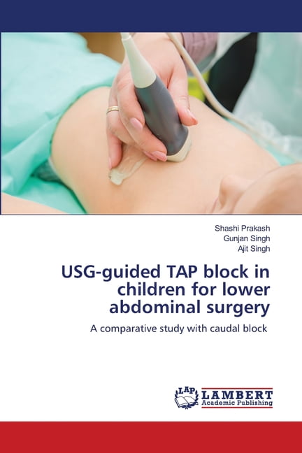 USG-guided TAP block in children for lower abdominal surgery (Paperback ...
