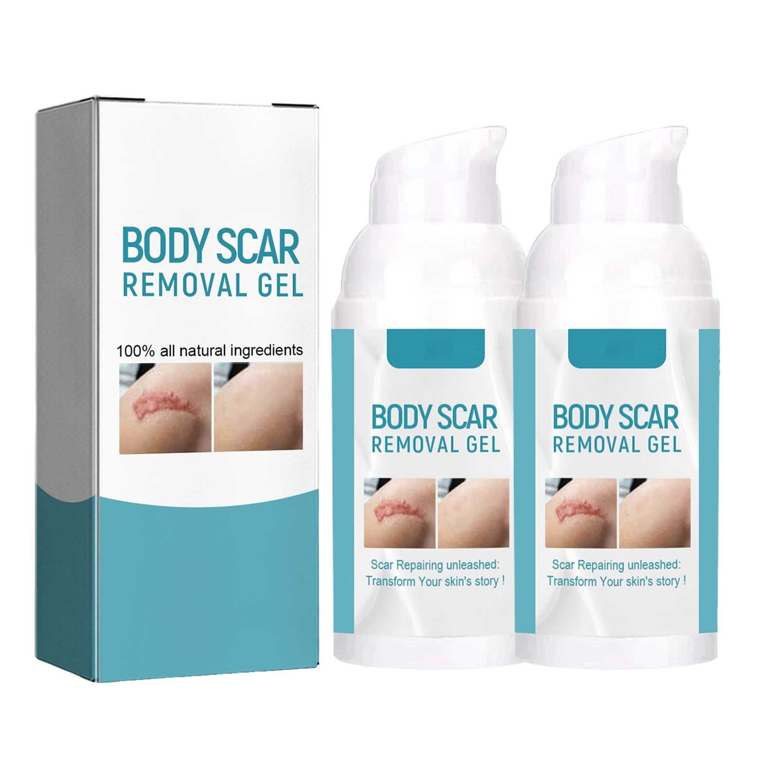 USky Silicone Scar Gel, Scar Cream - Advanced Scar Treatment for ...