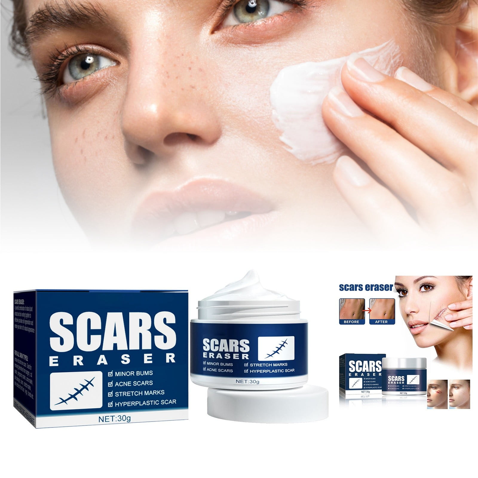 UYCDD 2024 Scar Fading Gel Skin Scar Gel Burns & Scar Formula - Walmart.com