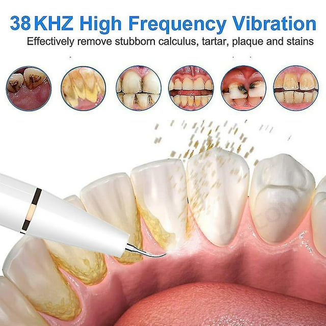 Ultrasonic Dental Scaler for Teeth Tartar Tooth Stain Dental Calculus ...
