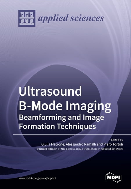 Ultrasound B-Mode Imaging: Beamforming and Image Formation Techniques ...