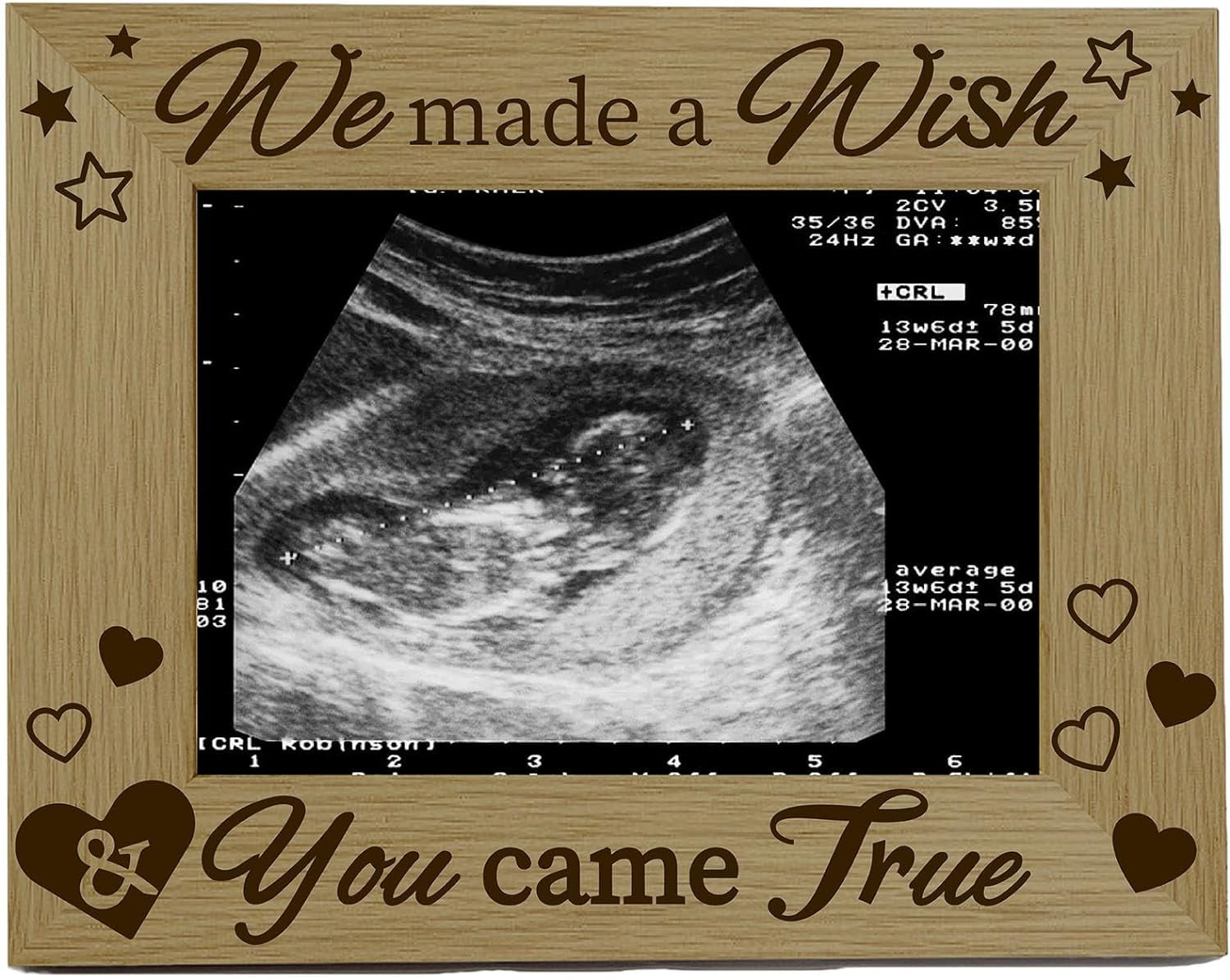 Ultrasound Picture Frame Sonogram Wood Photo Frames Engraved Display ...