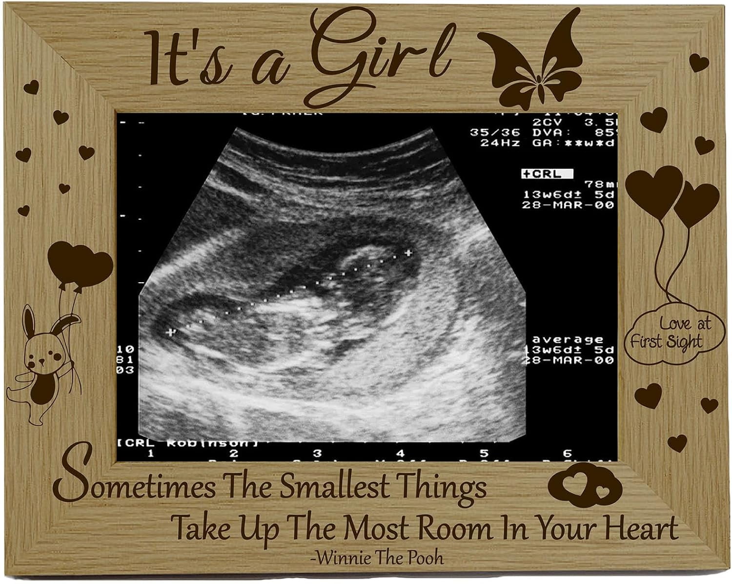 Ultrasound Picture Frame Sonogram Wood Photo Frames Engraved Display ...