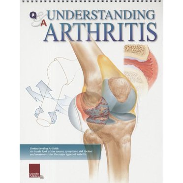 Understanding Arthritis Anatomical Chart - Walmart.com