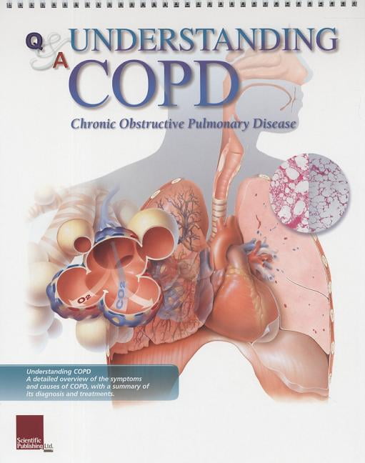 Understanding COPD Flip Chart (Other) - Walmart.com