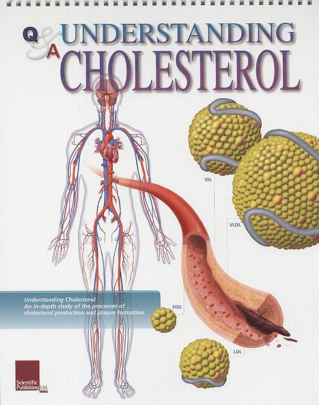 Understanding Cholesterol Flip Chart (Other) - Walmart.com