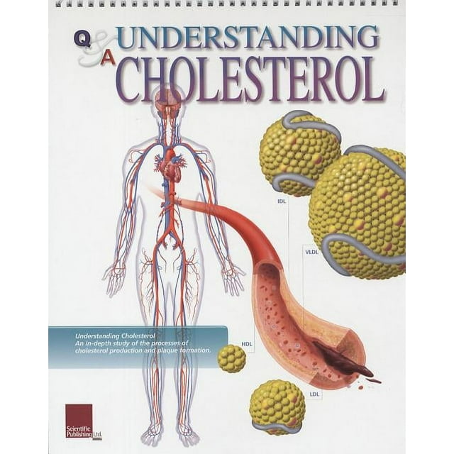 Understanding Cholesterol Flip Chart (Other) - Walmart.com