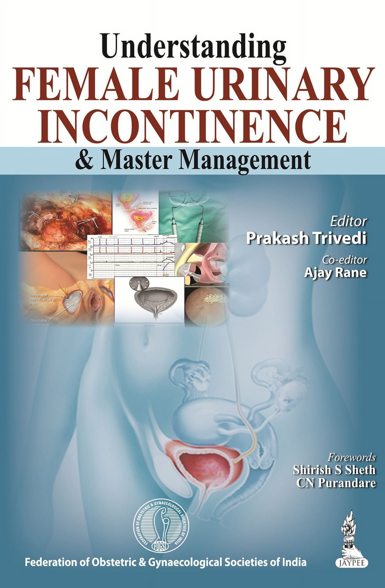Pre-Owned Understanding Female Urinary Incontinence & Master Management ...