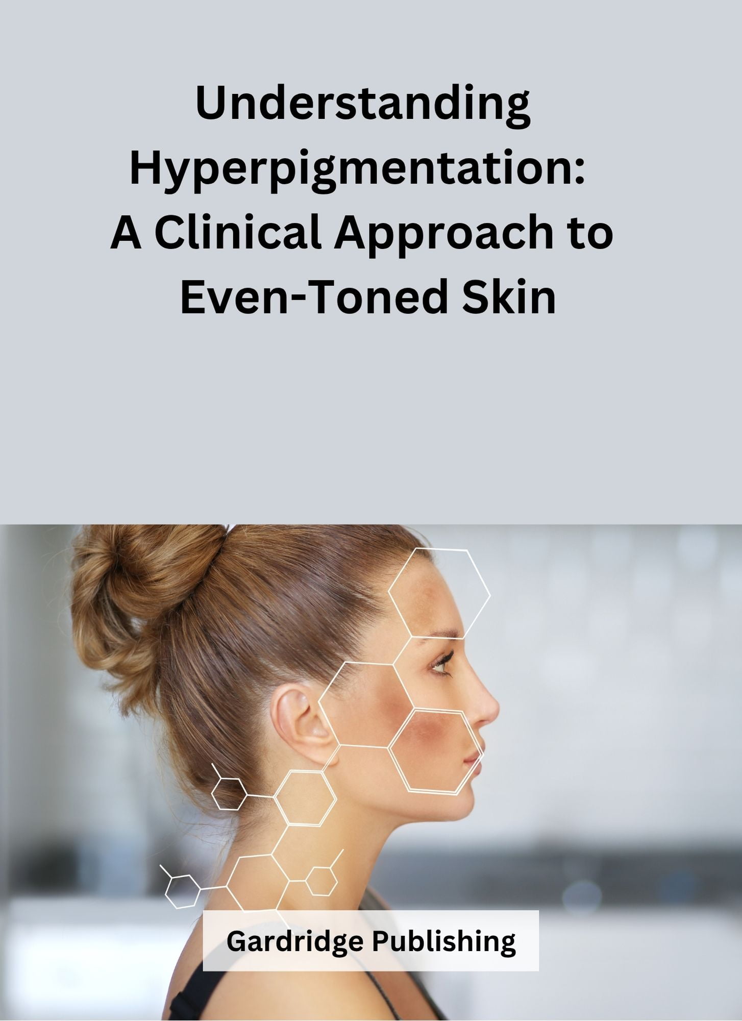 Understanding Hyperpigmentation: A Clinical Approach to Even-Toned Skin - Walmart.com