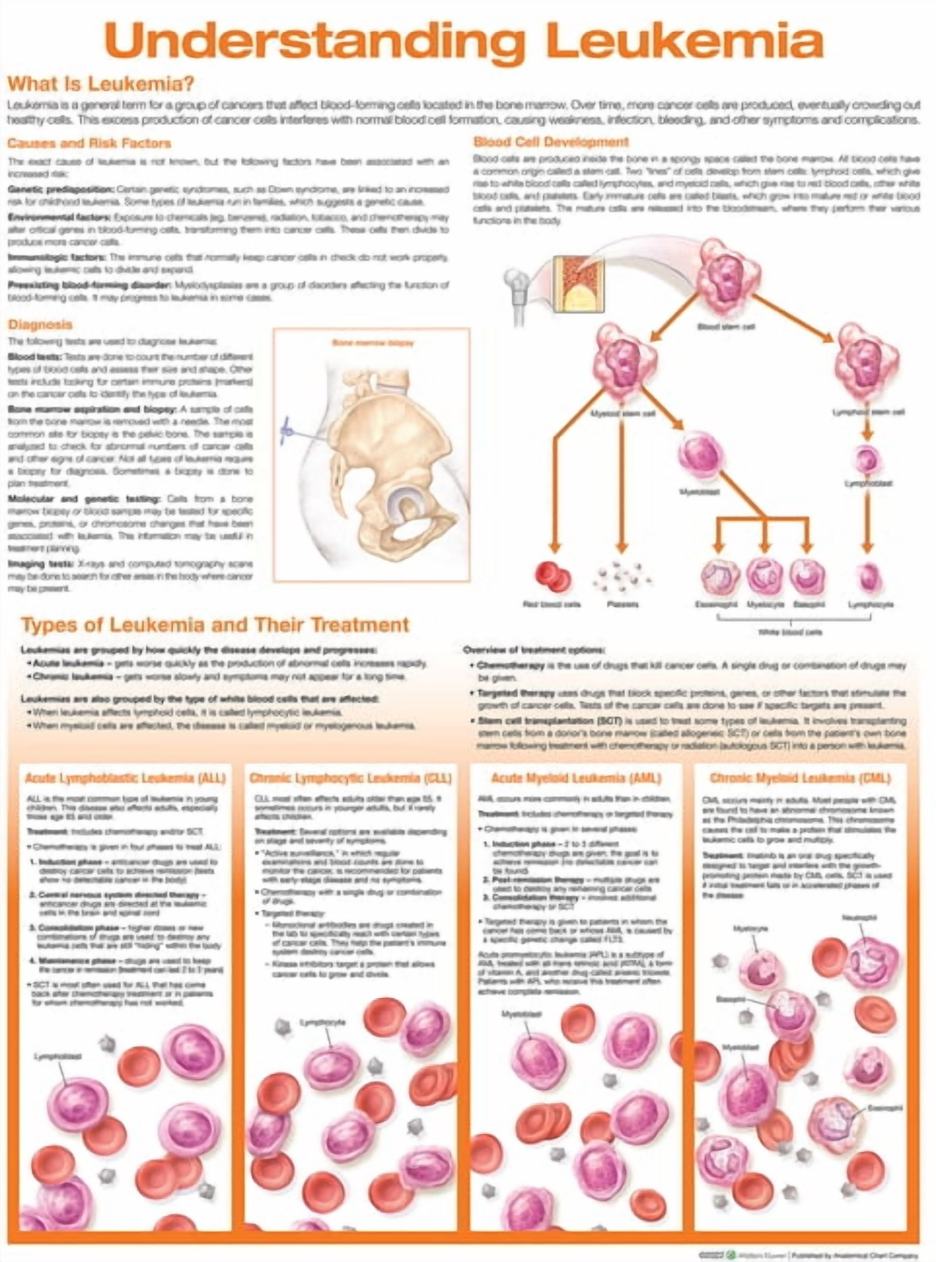 Understanding Leukemia Anatomical Chart (Other) - Walmart.com