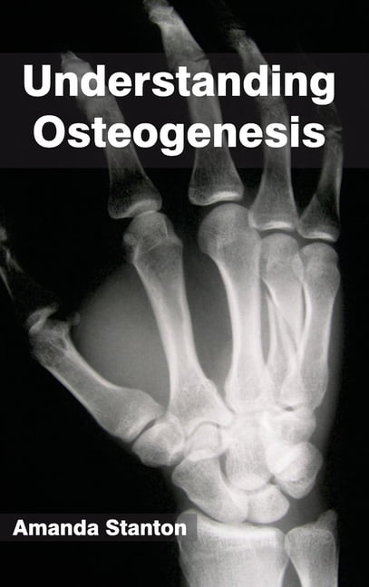 Understanding Osteogenesis - Walmart.com