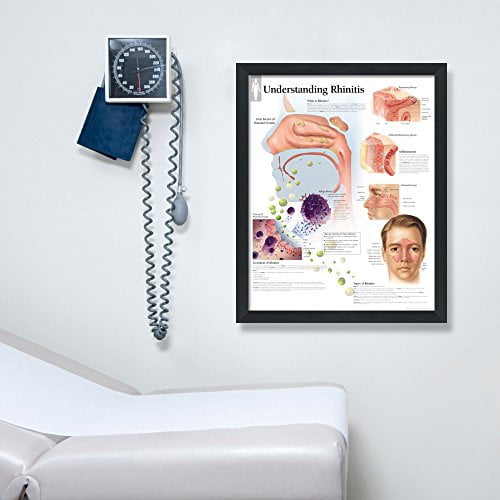 Understanding Rhinitis Framed Medical Educational Informational Poster ...