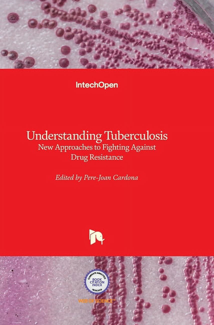 Understanding Tuberculosis - Walmart.com