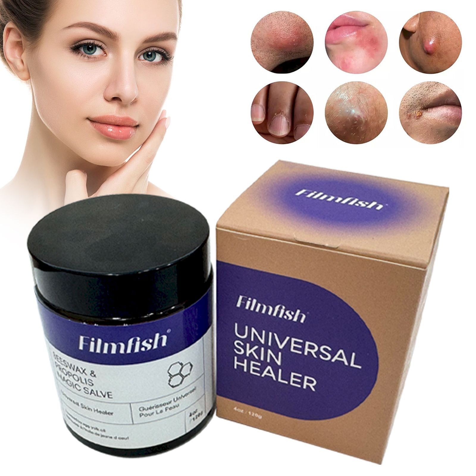 Universal Flare Care | Relief for 97% of Skin Issues | Cysts, Inflamed ...