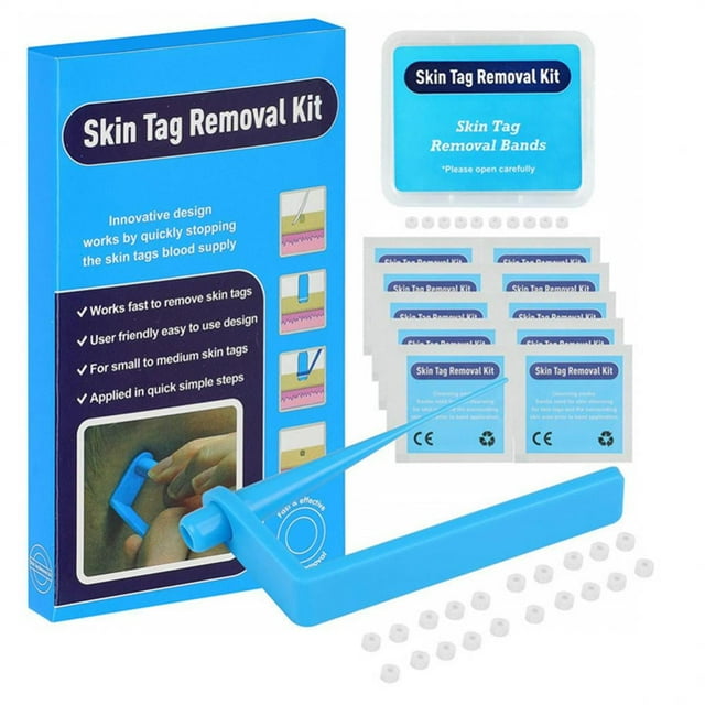 Universal Tag Removing Tool Skin Care For Fast Removing Warts And Skin ...