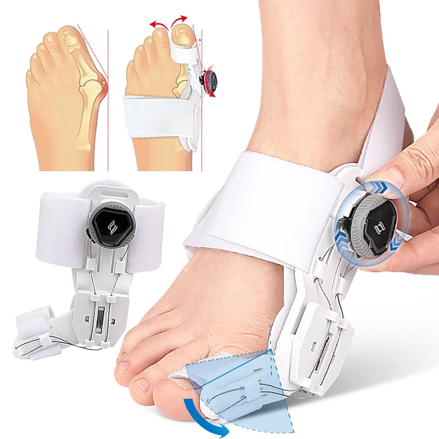 Upgraded Bunion Corrector, Adjustable Knob Bunion Splint for Bunion ...