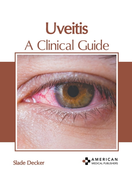 Uveitis: A Clinical Guide, (Hardcover) - Walmart.com