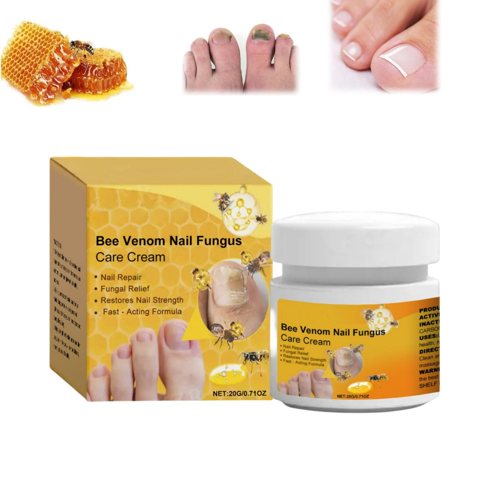 Uzozrs Be®e Ven®om Fungal Nail Treatment,Be®e Ven®om Nail Treatment ...