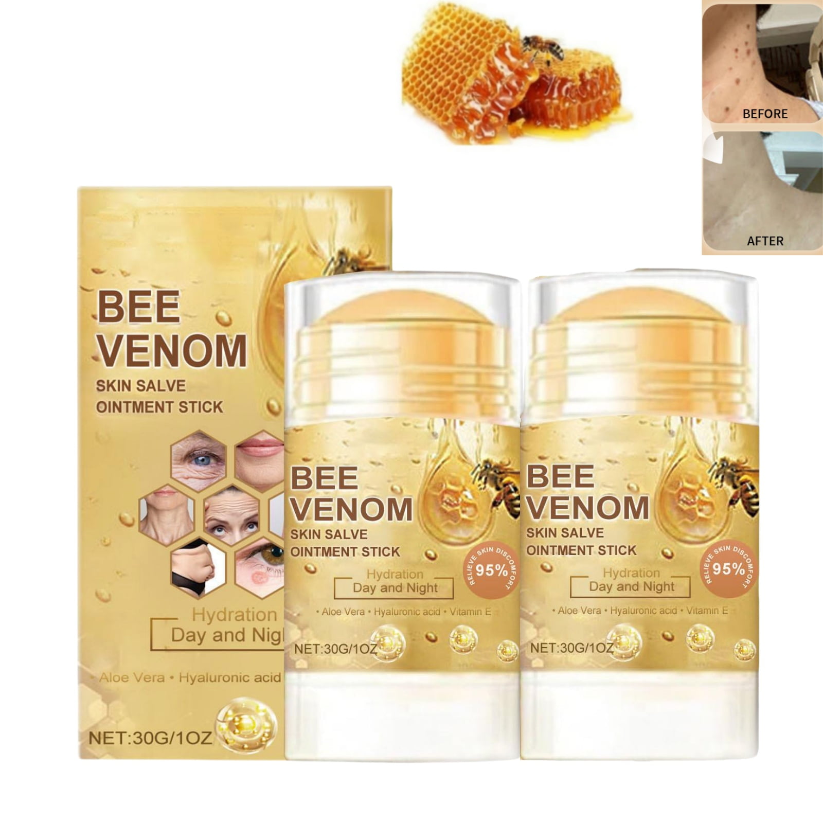 Uzozrs Be®e Ven®om Skin Salve Ointment New Be®e Ven®om Extract Soothing ...