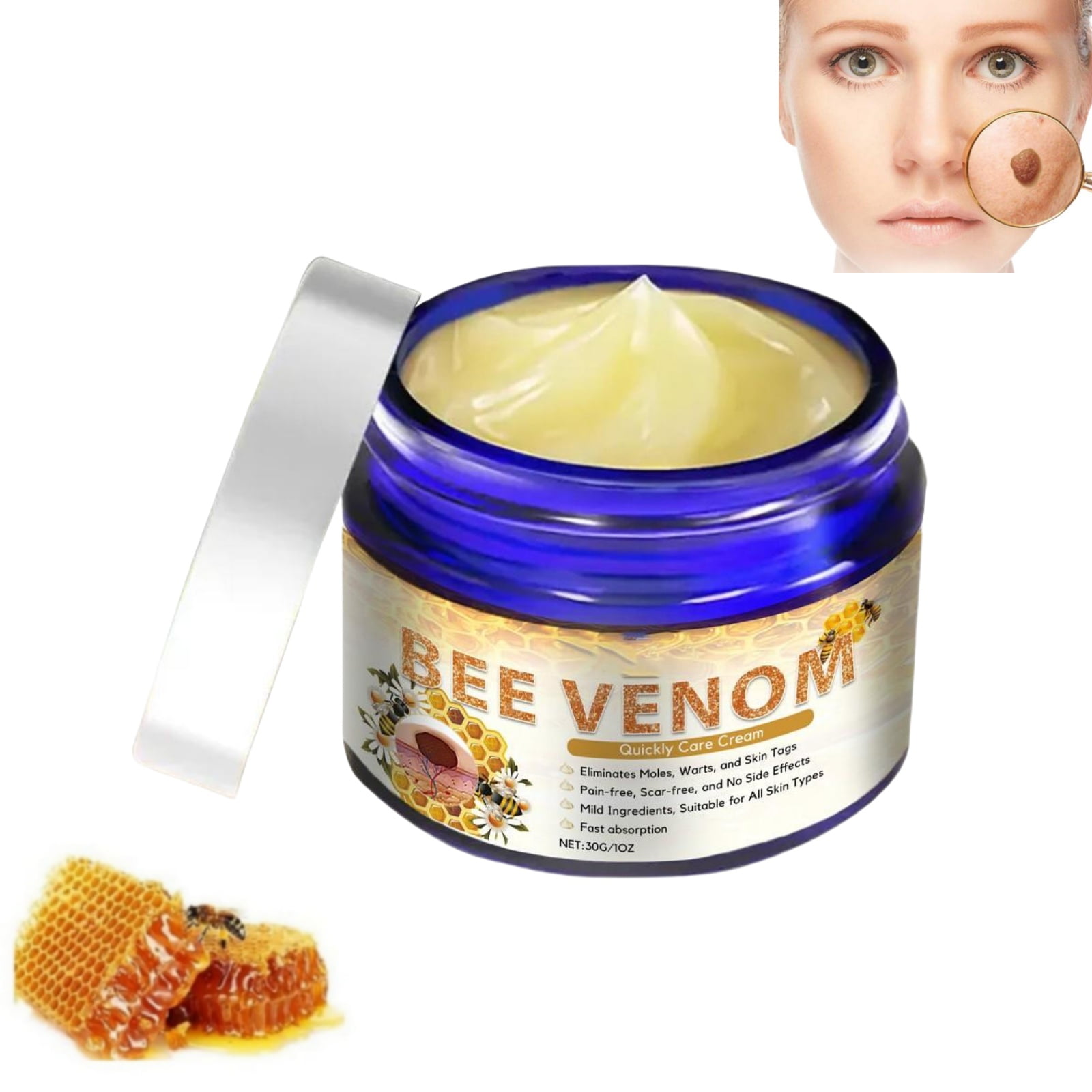 Uzozrs Be®e Ven®om Skin Treatment Cream,Professional Skin Repair Cream ...