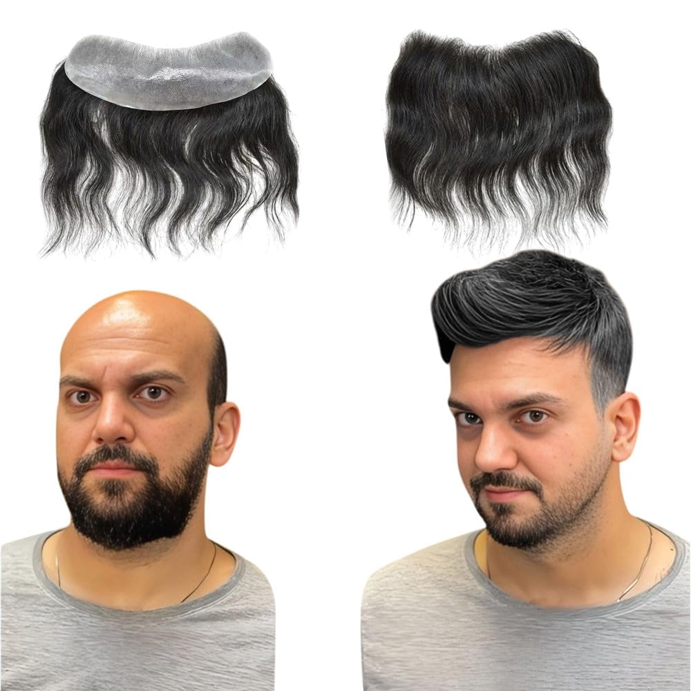 VIEWS Men Forehead Hairline Toupee 100 Human Hair Skin PU Man ...