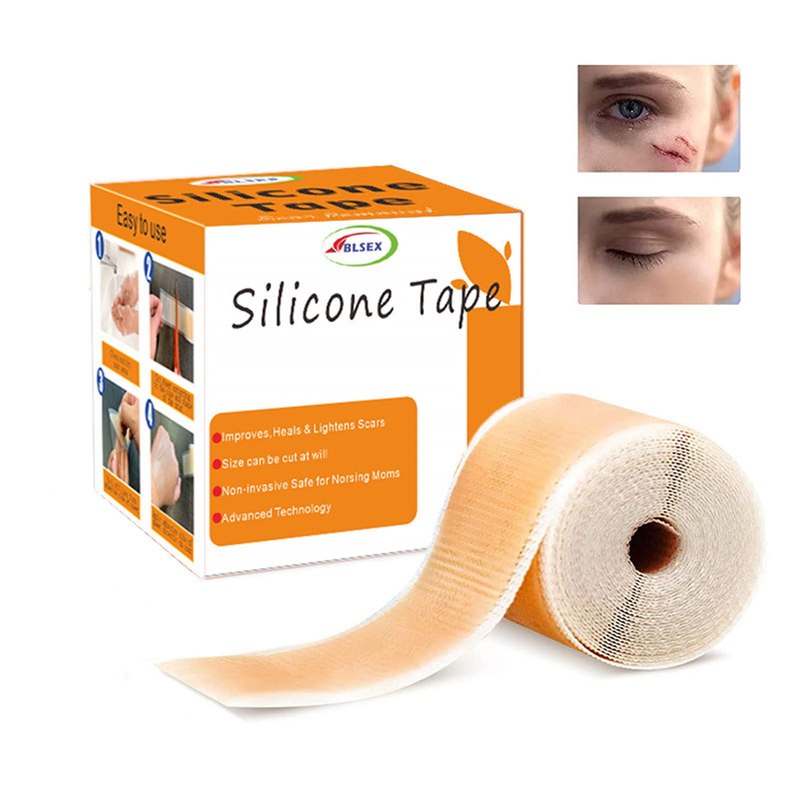 Vadktai Deals Silicone Scar Sheets, Medical Silicone Scar Tape Roll ...