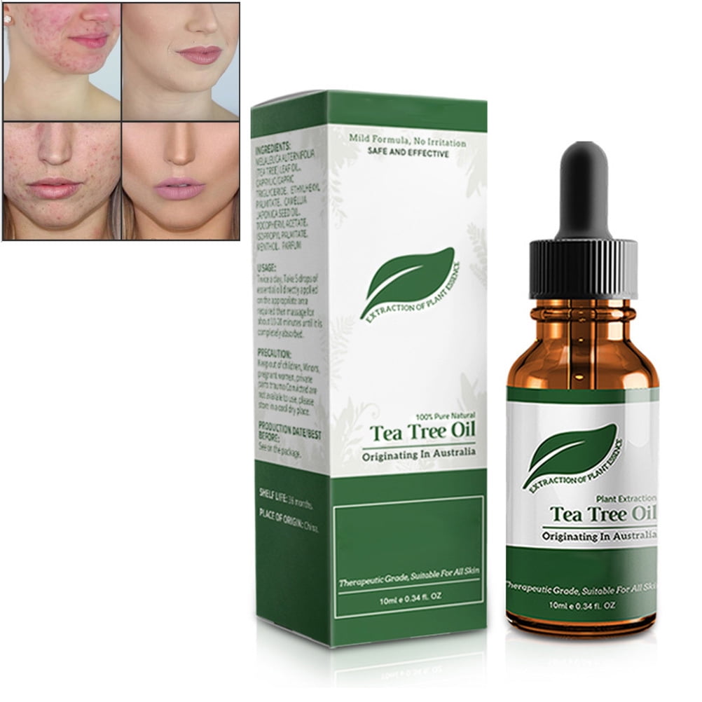 Valatala Tea Tree Oil Moisturizing Tea Tree Essential Oil for Blemished ...