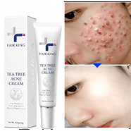 Adult Acnomel Acne Cream, 1.3 Oz - Walmart.com