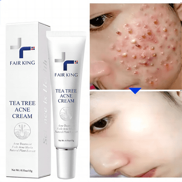 Adult Acnomel Acne Cream, 1.3 Oz - Walmart.com