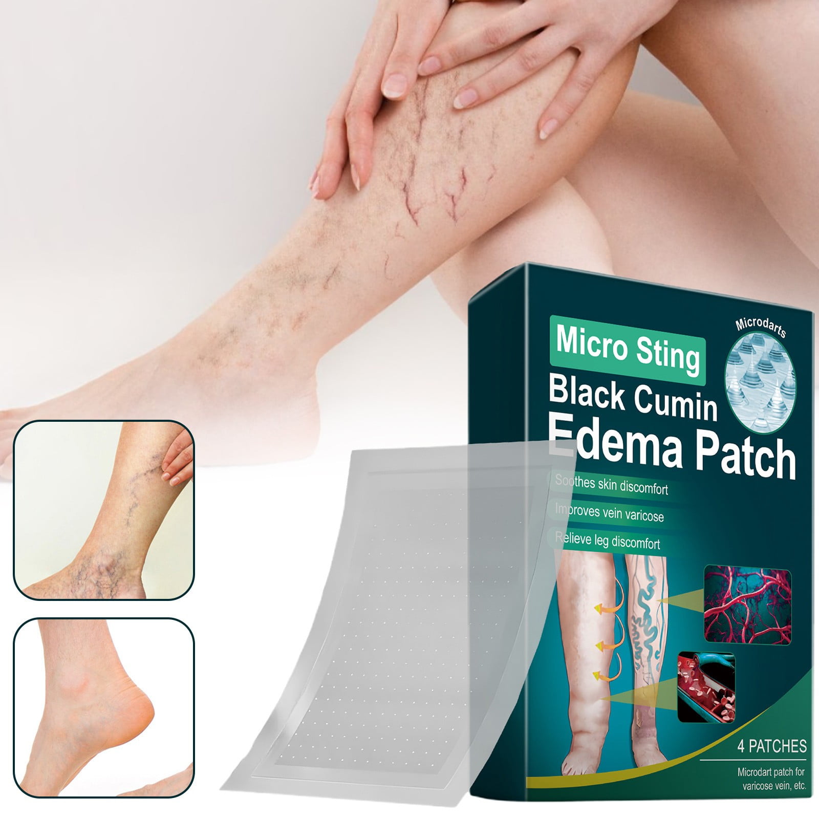Varicose Vein Edema Patch - Micro-Needle Patch, Leg Vein Discomfort ...