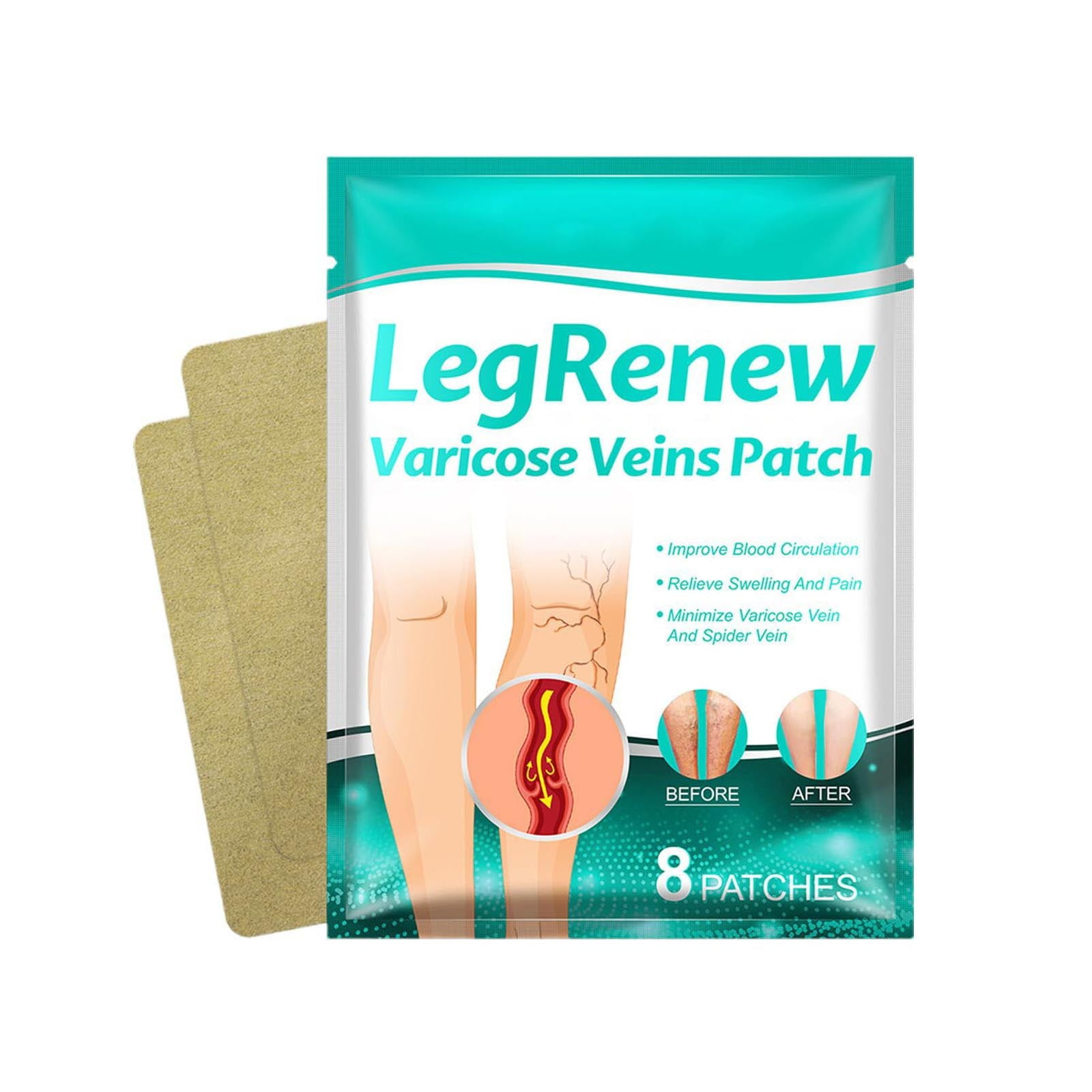Varicose Vein Patch A Patch Varicose Veins In The Legs Improves The ...