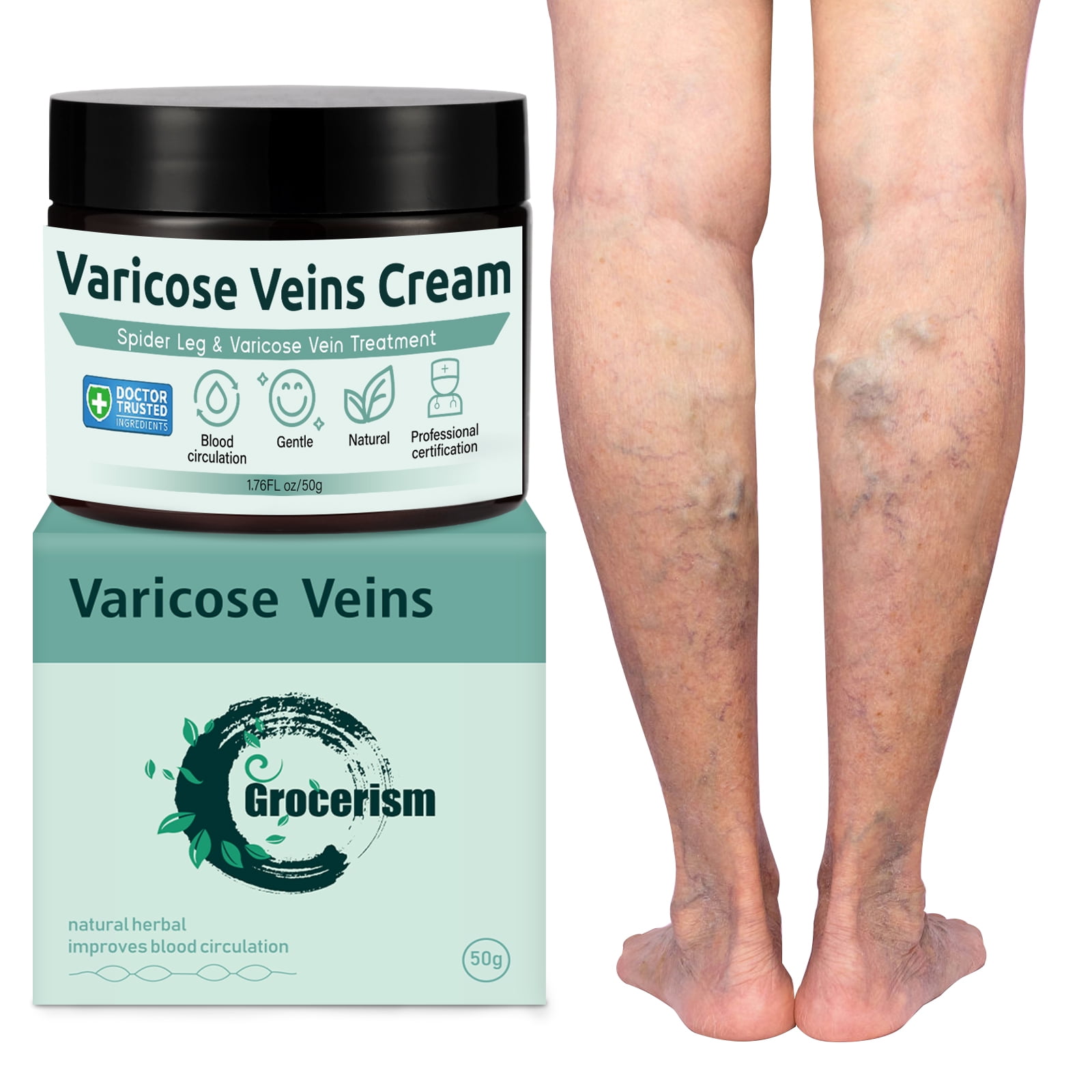 Spider Veins Treatment