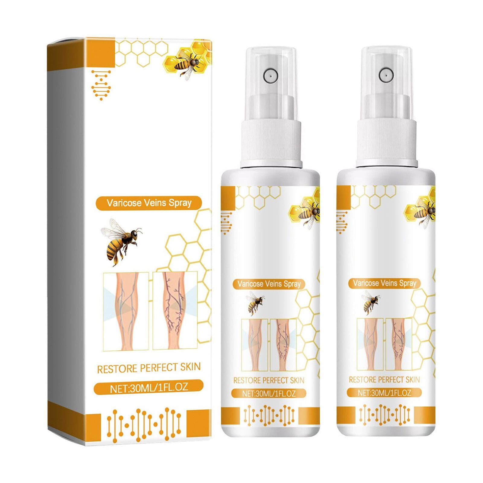 Varicose Veins Spray, Varicose Veins For Removing Varicose Veins ...