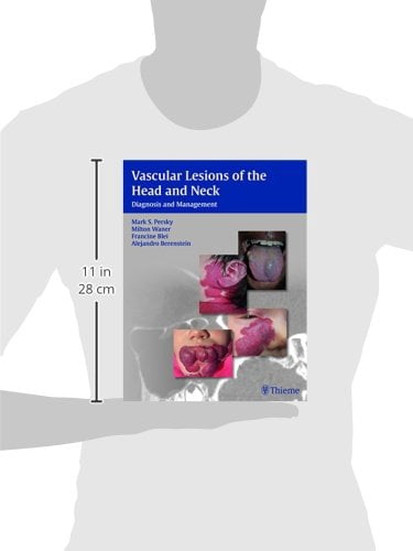 Pre-Owned Vascular Lesions of the Head and Neck: Diagnosis and ...