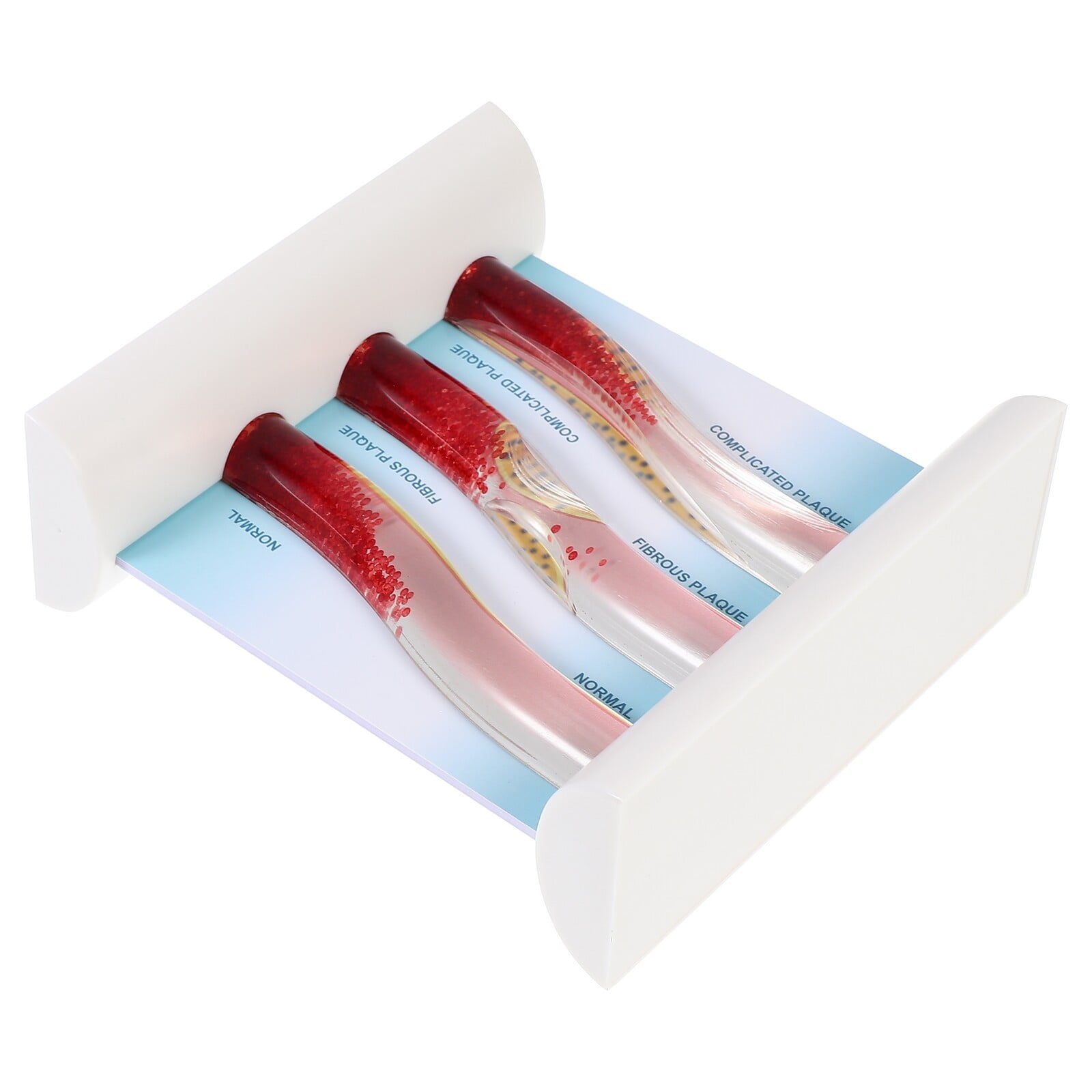 Human Body Skeleton Anatomy Model Low Density Lipoprotein Blood Vessel ...