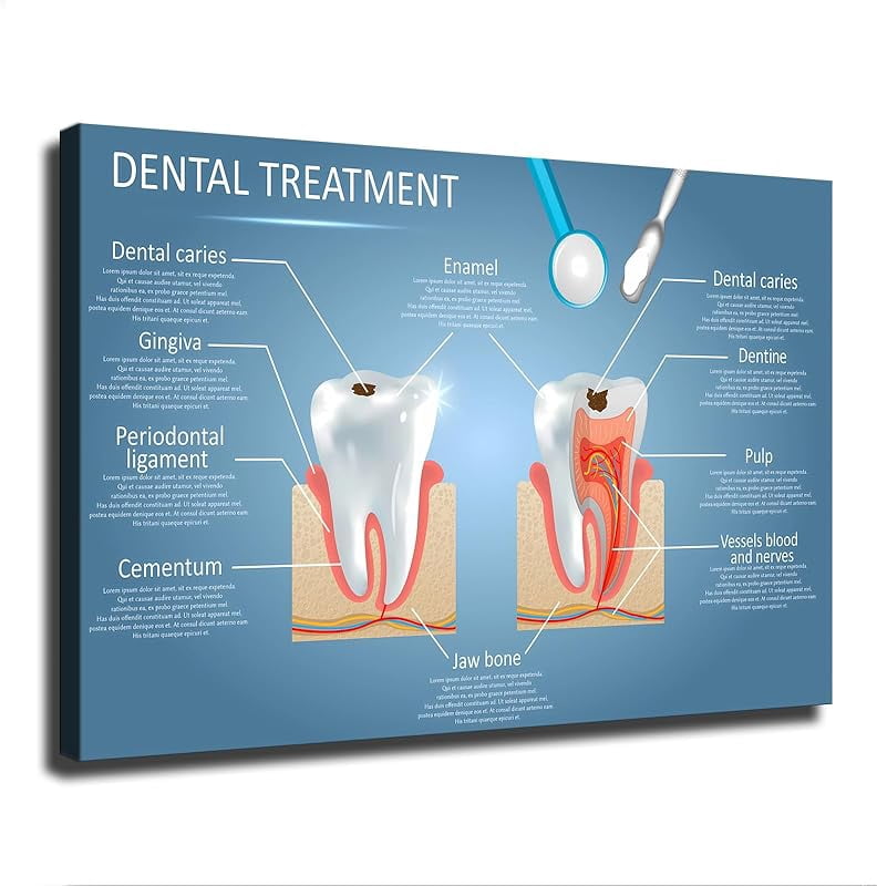 Vector Dental Anatomy and Tooth Structure Diagram Poster Canvas ...