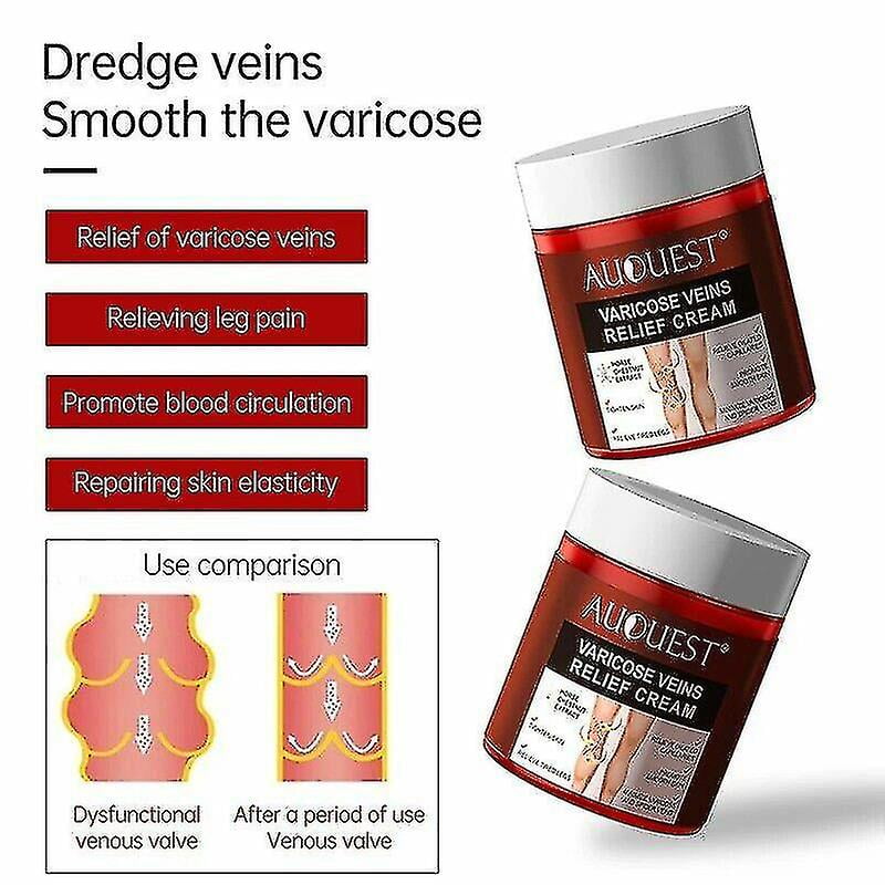 Veins Relief Varicose Cream Phlebitis Angiitis Vein Inflammation ...