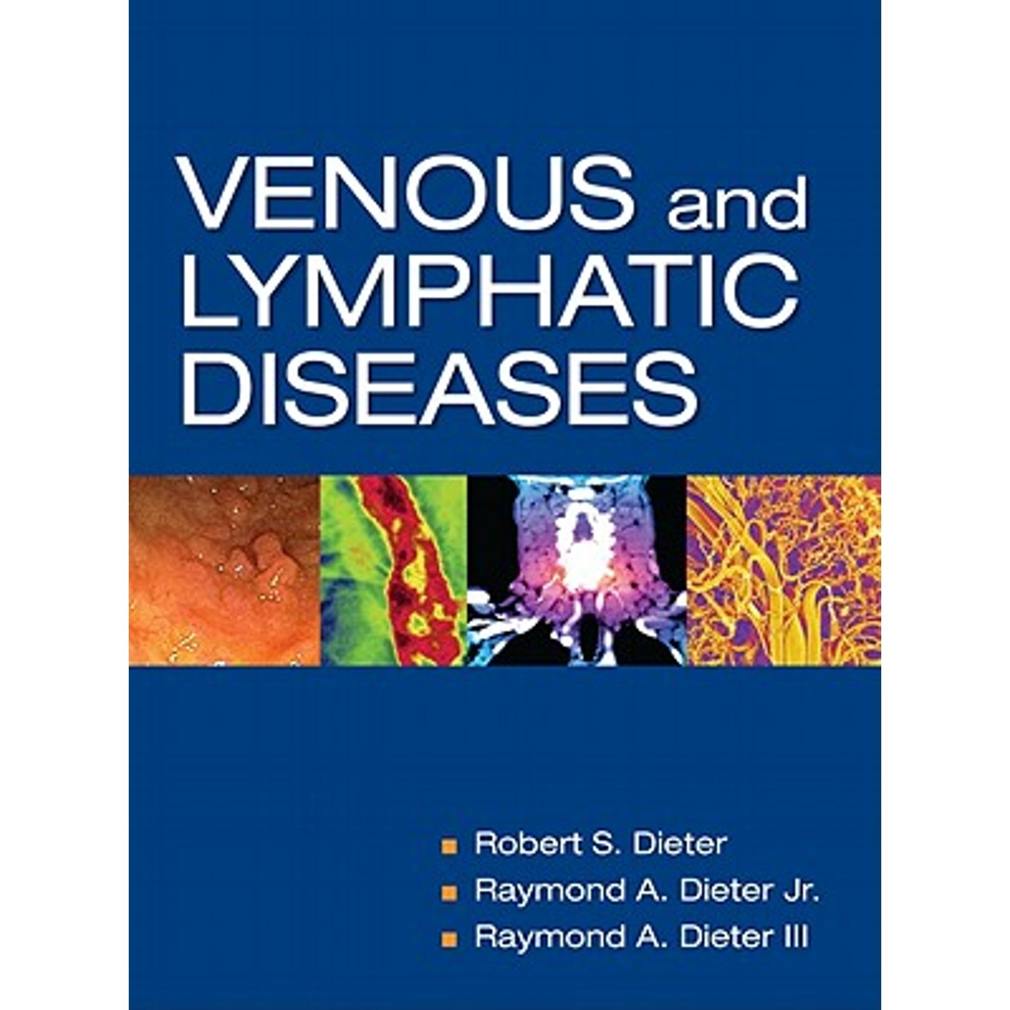 Pre-Owned Venous and Lymphatic Diseases (Hardcover) 0071601589 ...