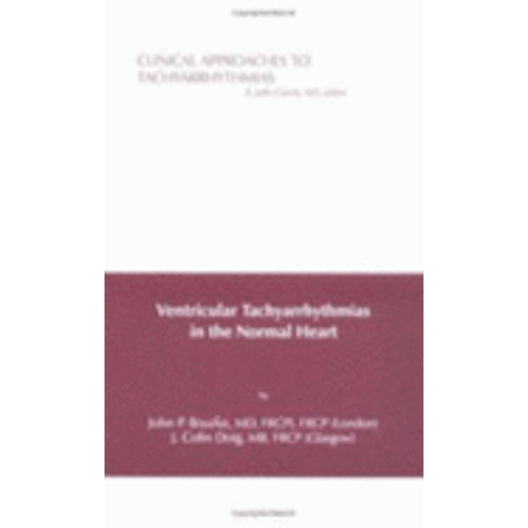 Ventricular Tachyarrhythmias in the Normal Heart - Doig, J. Colin ...