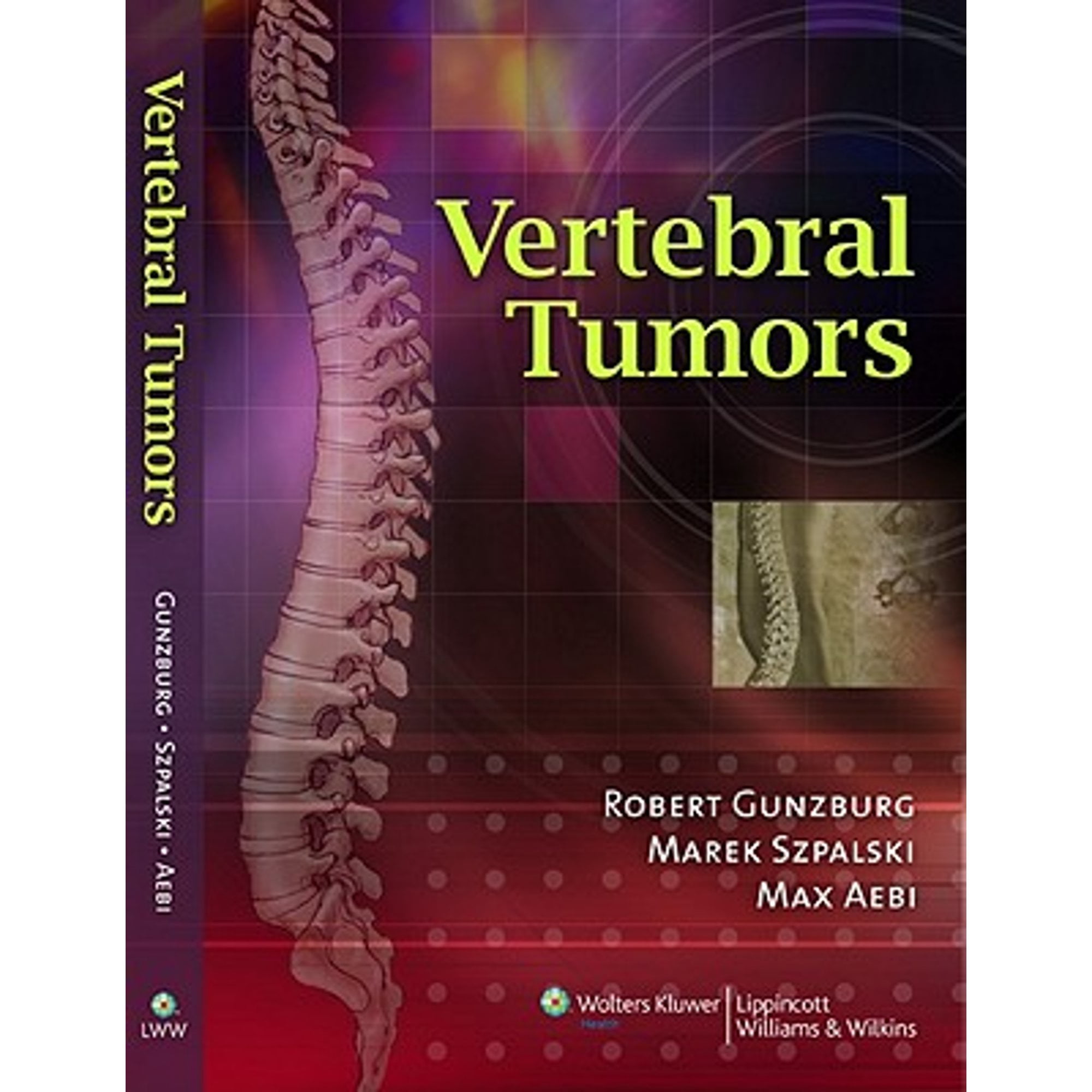 Pre-Owned Vertebral Tumors (Hardcover) by Robert Gunzburg, Marek ...